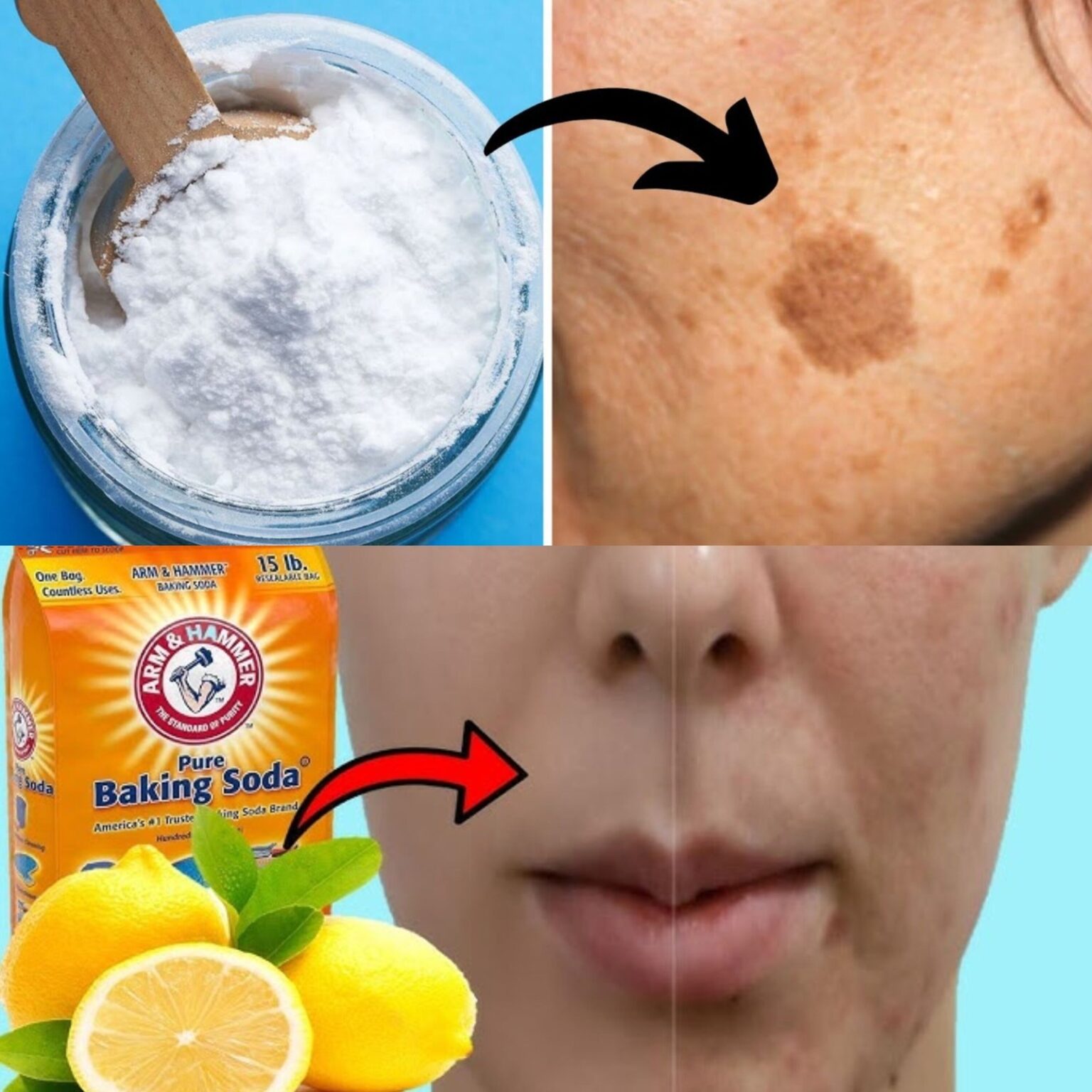 Baking soda can help get rid of age spots, acne, and blackheads! This ...